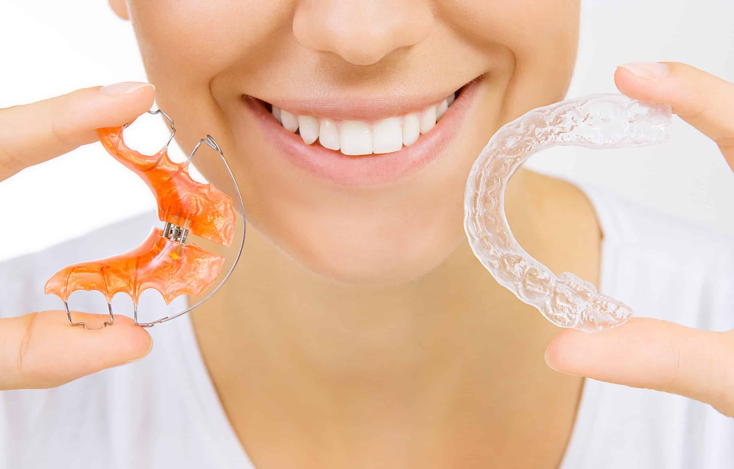 Celebrate National Retainer Day with Smile Boutique: Why Retainers ...
